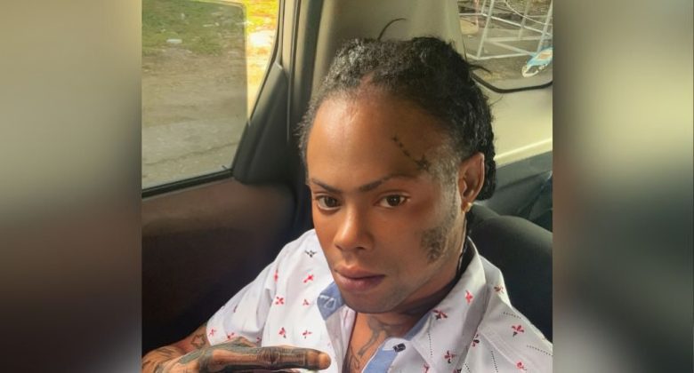 TikToker Candy's Bail Extended After Getting Charged with Wounding with ...